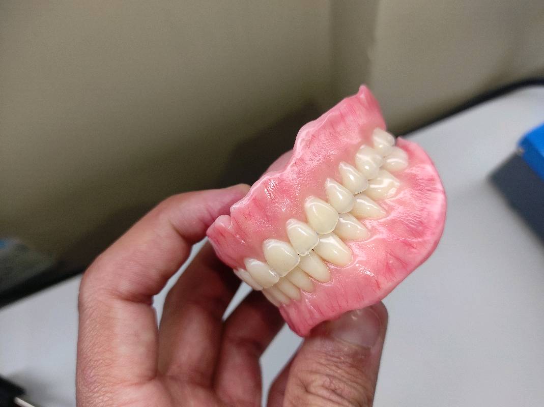 Protesis total caracterizada en Tulcan