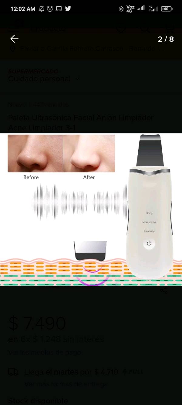 Paleta ultrasónica facial anlan limpiador acne limpiador 3-1 Paleta ultrasónica facial anlan limpiador acne limpiador 3-1
