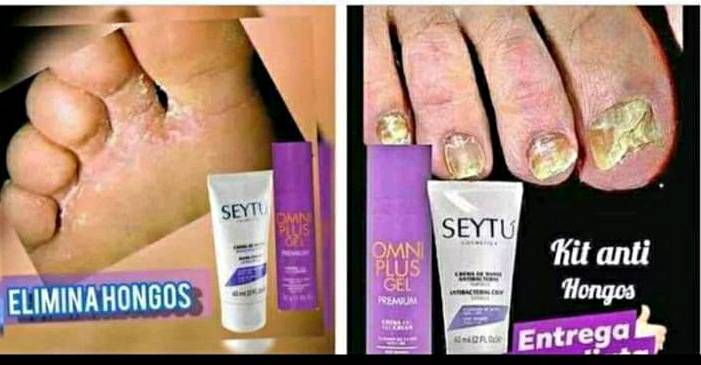 Kit Para Eliminar Hongos en Intibuca