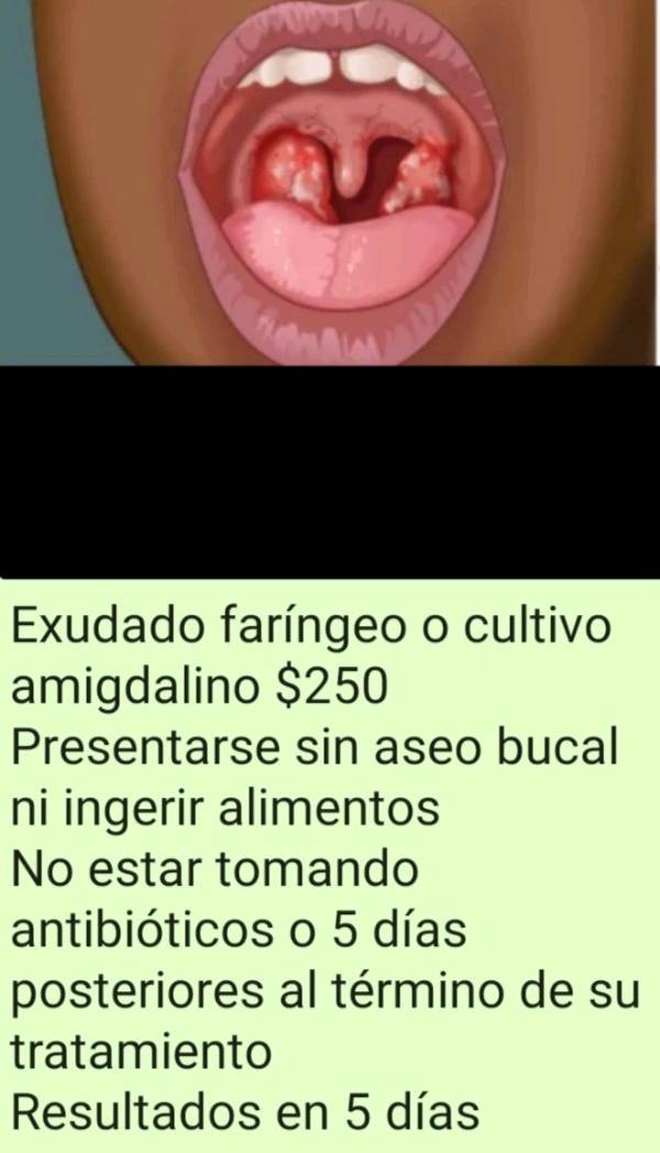 Exudado faríngeo o cultivo faríngeo en General Escobedo