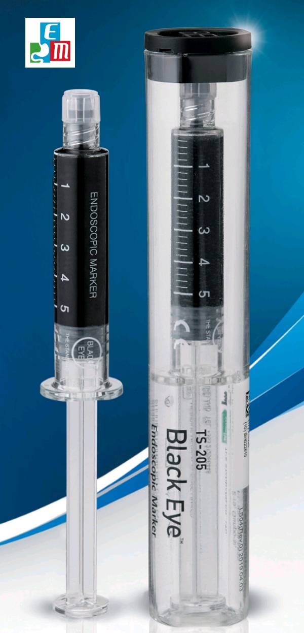 Black eye (endoscopic marker) en Chalco de Díaz Covarrubias