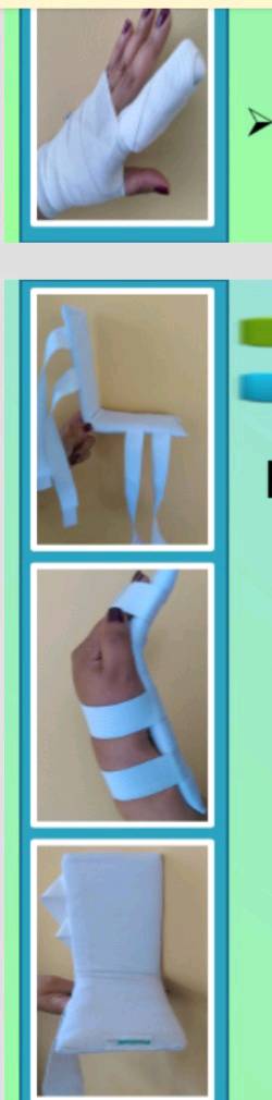 Férulas moldeables en Lima