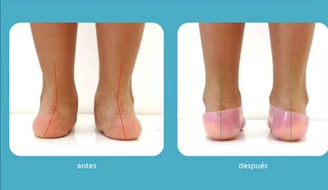 insert foot en Mexico City