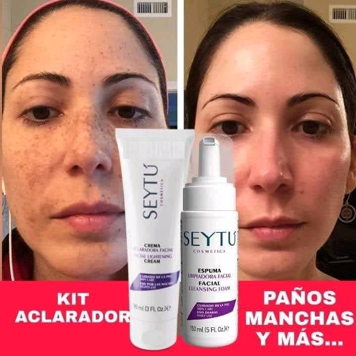 KIT MANCHAS SEYTU en Ipiales