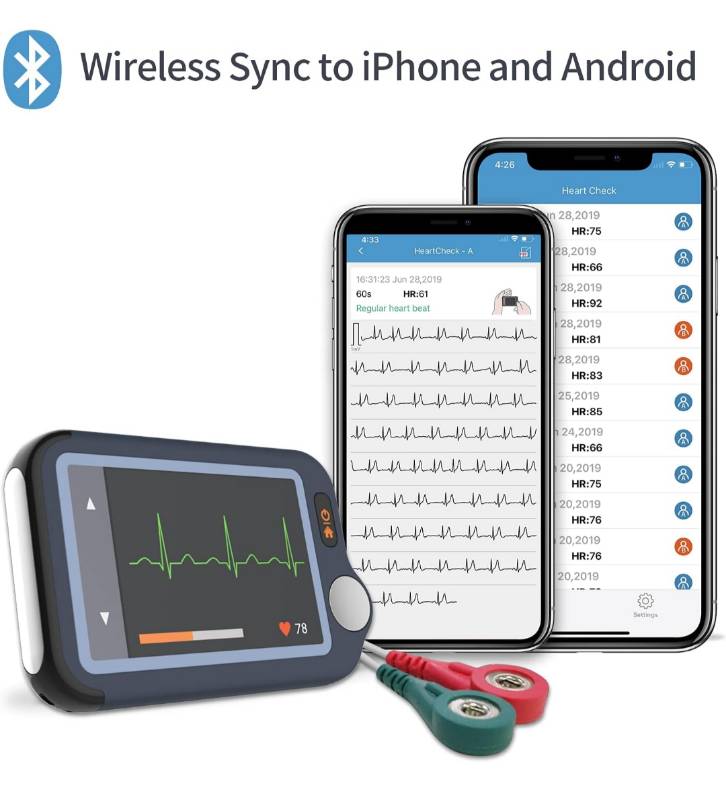 Wellue Monitor de ECG, Monitor de Corazón con ECG, Dispositivo de EKG ...