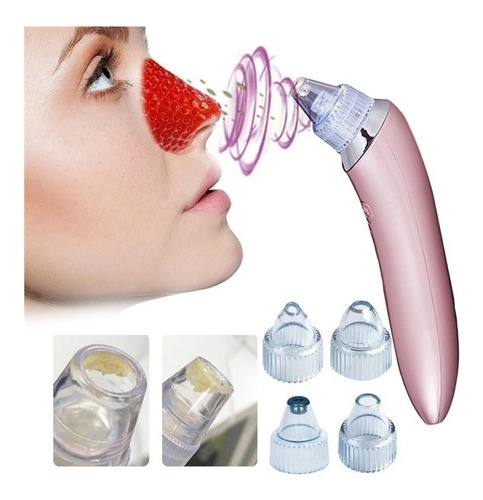 Estractor de puntos negros en Guayaquil